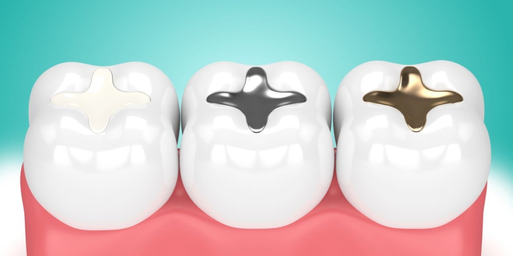 Plombage gris vs blanc : différences, avantages et choix à Blainville